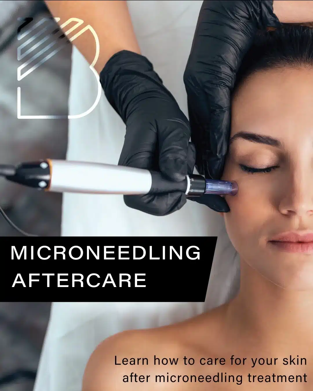 Microneedling Aftercare
